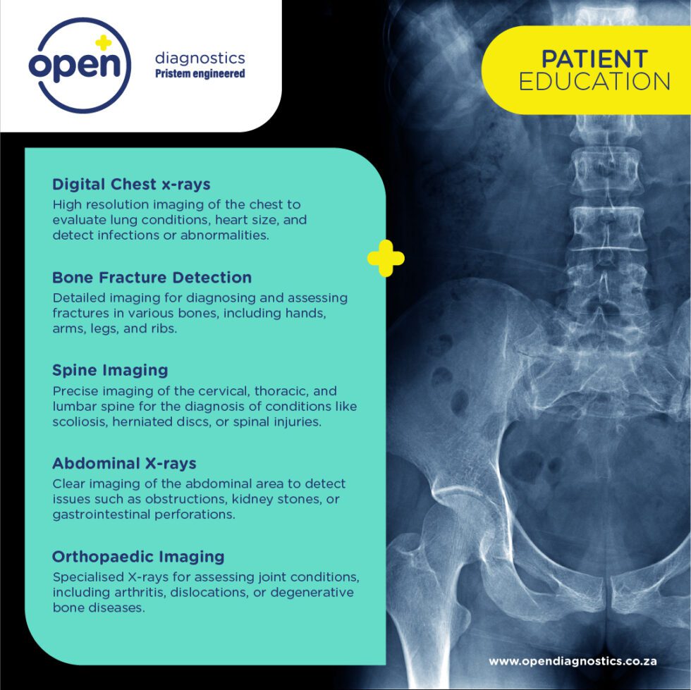 Understanding your imaging procedure - Open Diagnostics