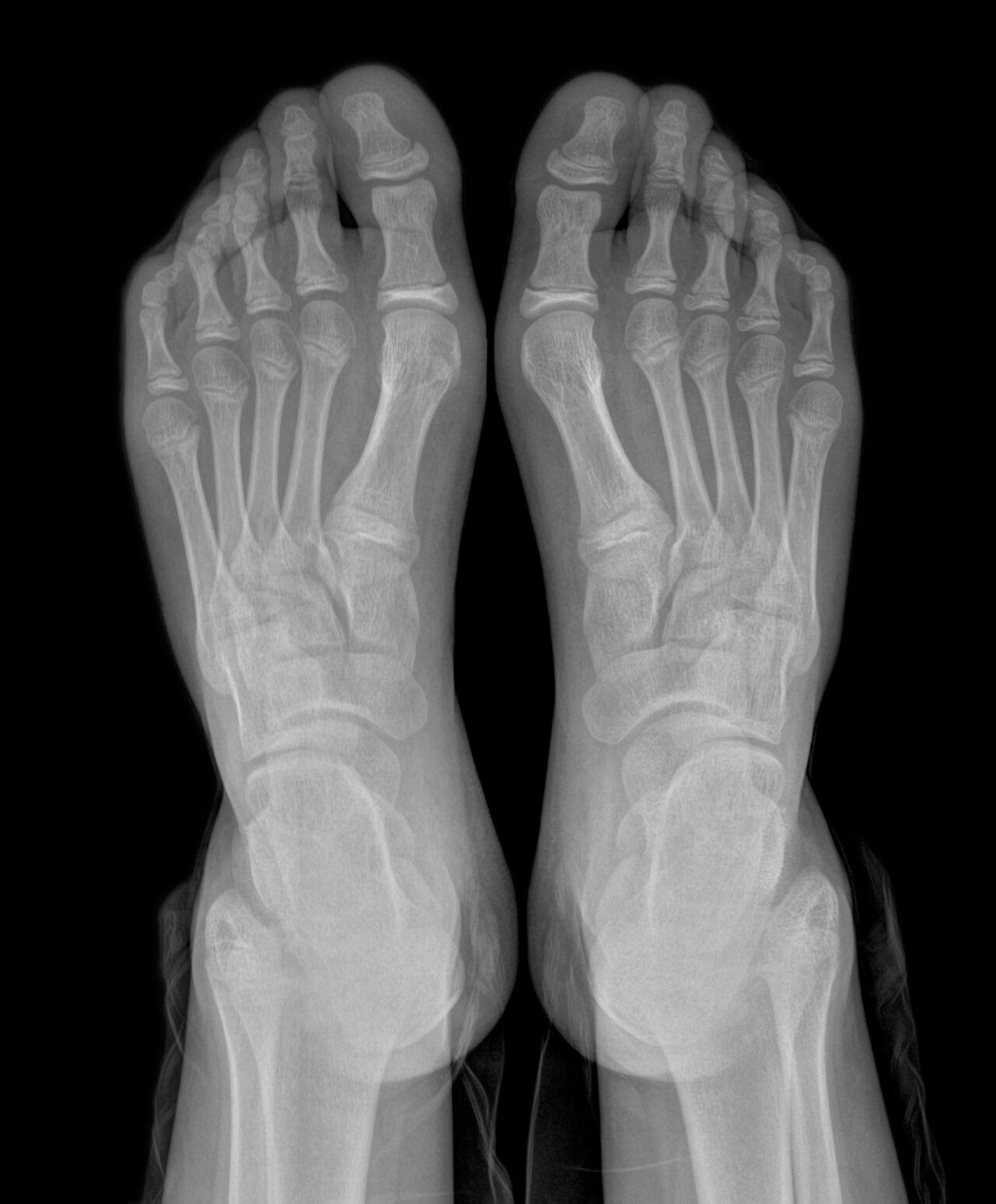 WHY ARE FOOT X-RAYS IMPORTANT?